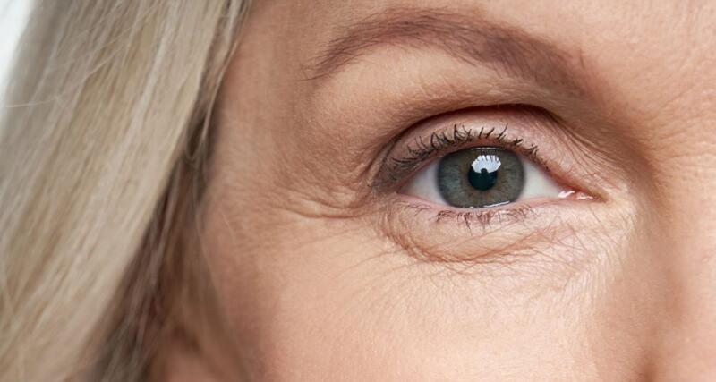 Parksville’s Non-Surgical Eye Lifts – Elegance Sculpting